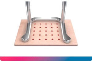 Youlaser MT - Medsystems